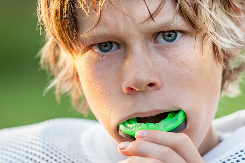 Sports Mouthguards – Farinacci Dental Care